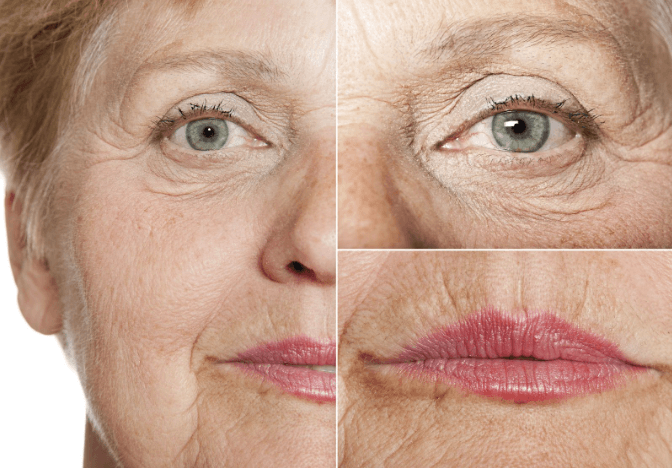 Skin Resurfacing Houston | Athré Facial Plastics